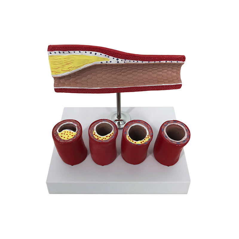 Anatomical PVC Artery Model Plastic Medical Science Model with 4 Artery ...