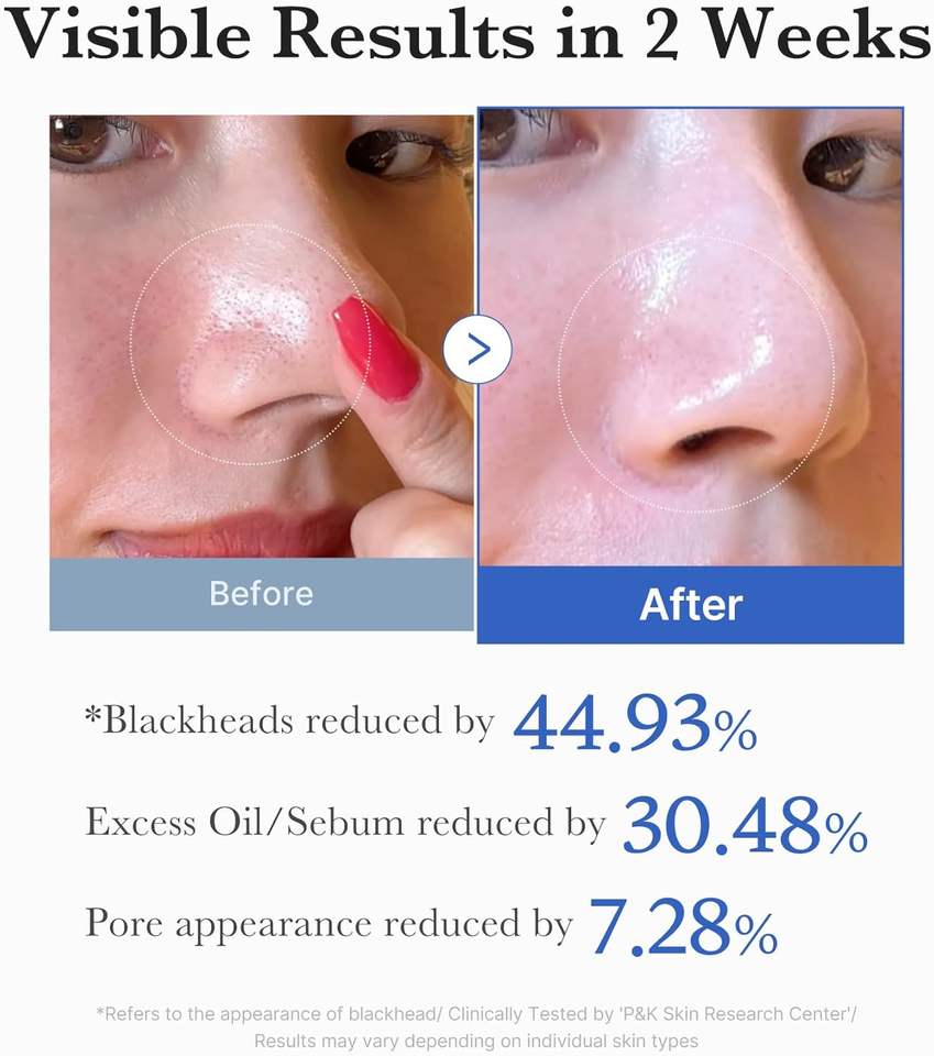 SkinCare Salicylic Acid Zero Pore Cotton Pads Exfoliating AHA BHA ...