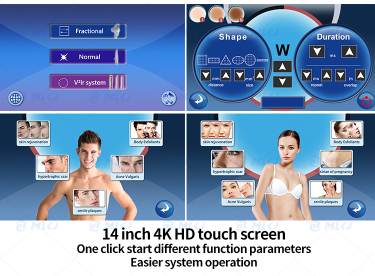 Co2 Fractional Laser Acne Scar Removal Co2 Fractional Vaginal