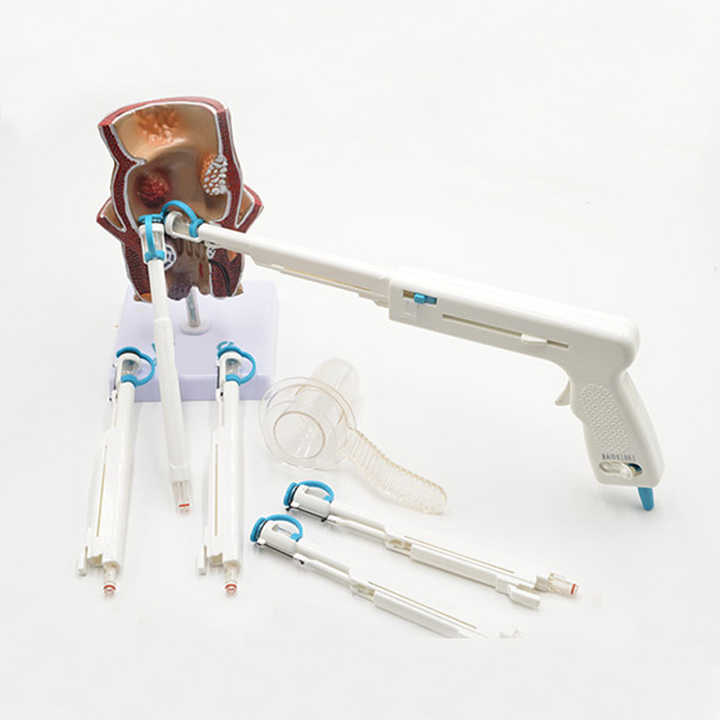 Disposable Manual Power Anal Hemorrhoid Ligation Device for Anorectal ...