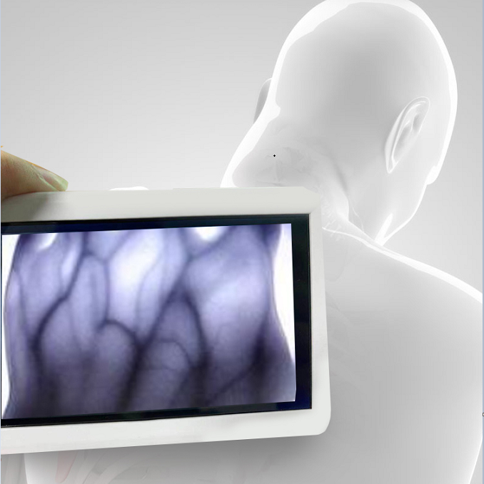 Infrared Vein Scanner - Portable and Accurate Vascular Imaging