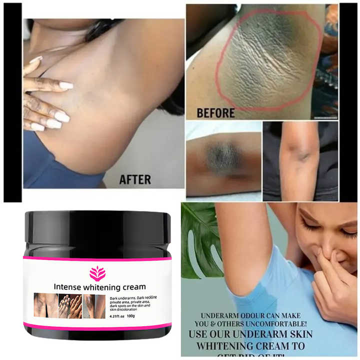 New Arrival Dark Knees Knuckles Elbows Armpit Intense Whitening Cream ...