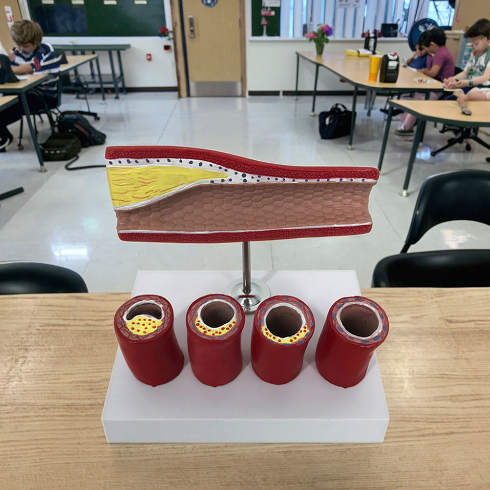 Anatomical PVC Artery Model Plastic Medical Science Model with 4 Artery ...