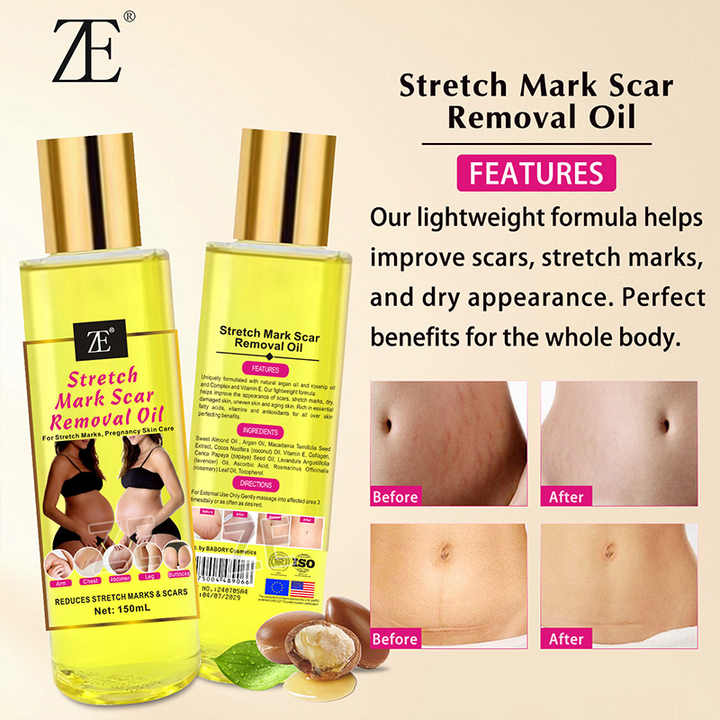 Body Stretch Marks Oil Pregnant Scar Effective Repair Remover Plant ...
