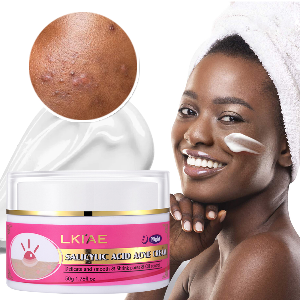 Cream for chocolate skin store