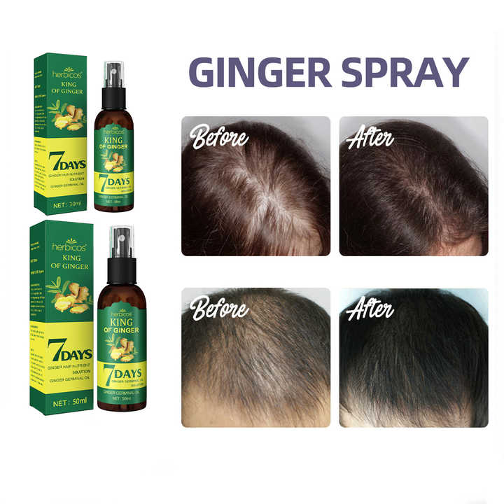 Herbicos Green Ginger Anti-Hair Prevent Loss Oil,Ginger 7 Days Hair ...