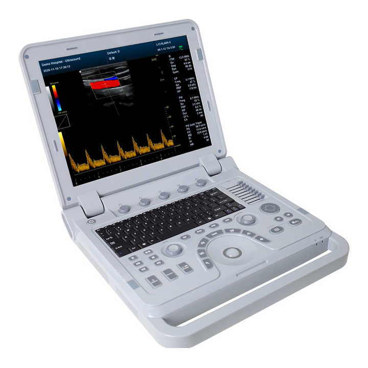 CONTEC CMS1700B ultrasonido ultrasonic equipment ultrasound scan ...