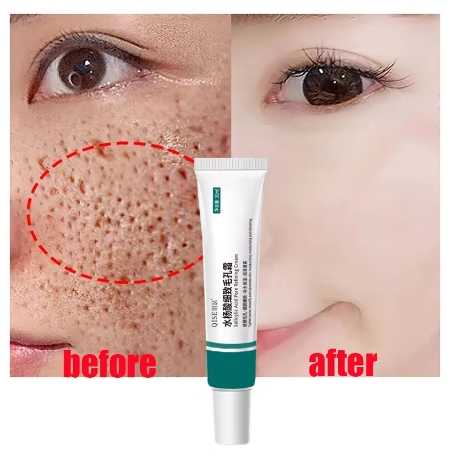 Hot Salicylic Acid Pore Shrinking Cream - 30g Face Serum