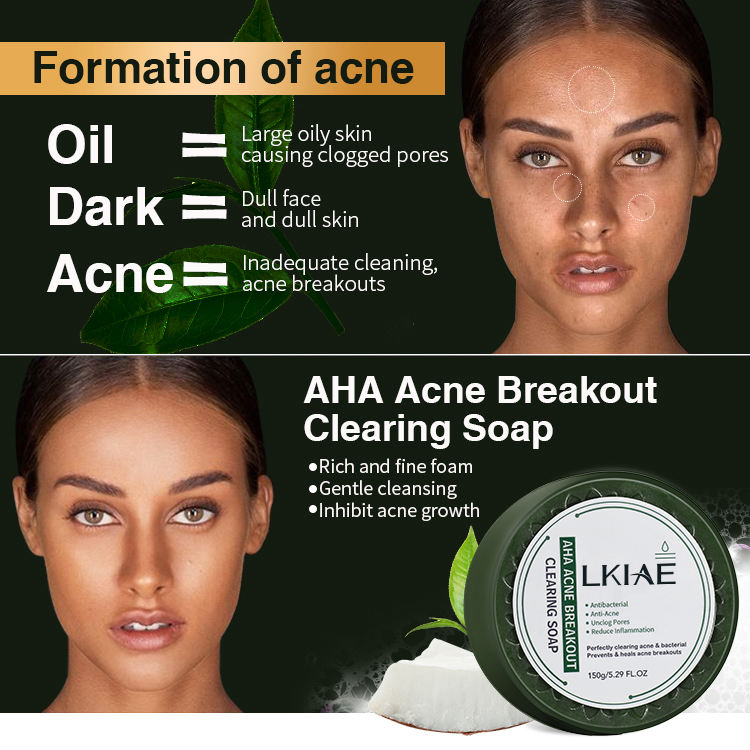Ailke Manufacturing 100% Organic AHA Handmade Soaps for Acne