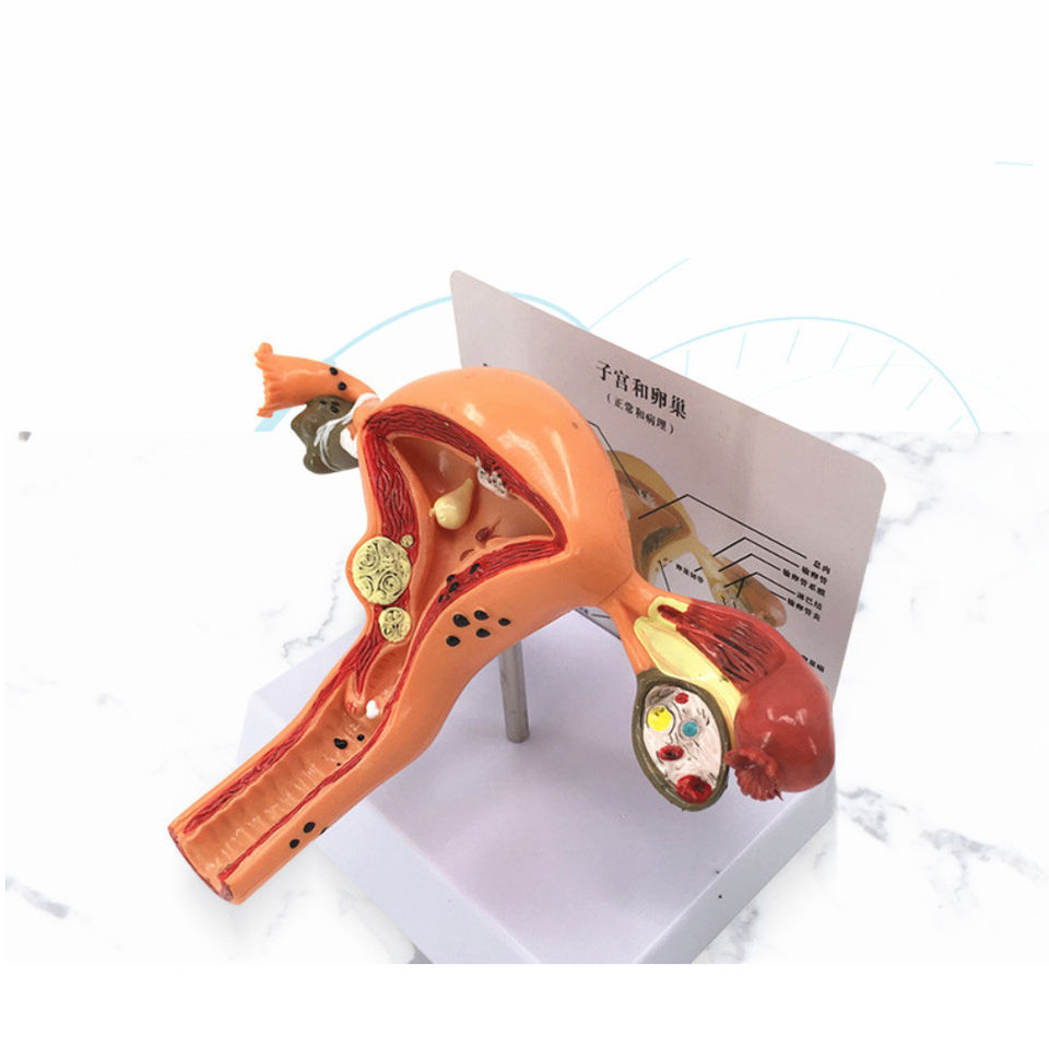 Enlarged Model of Female Uterus Female Reproductive Anatomy Model ...