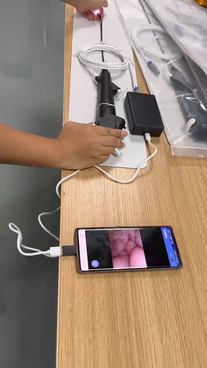 Factory Mini Camera Endoscopic Camera Module Oem for Mininally Invasive ...