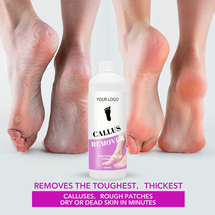 250ml Callus Remover Gel - Exfoliating Foot Care