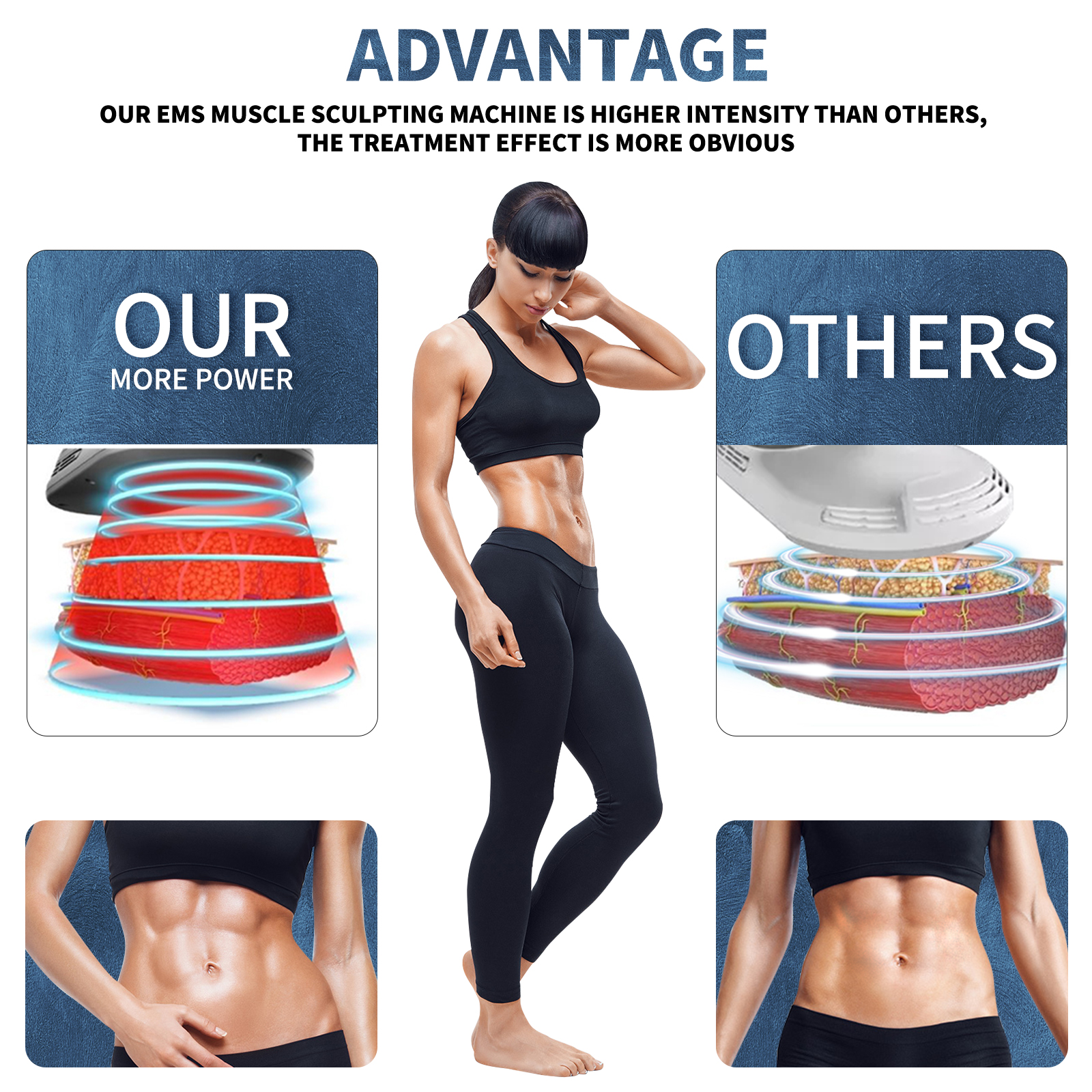 EMS Muscle Machine: Body Contouring Device For Muscle Stimulation, Fat ...