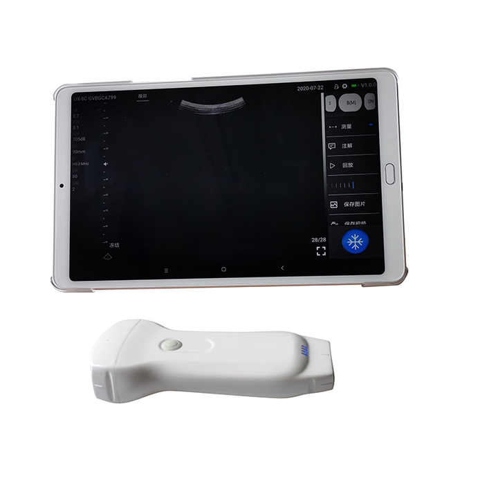 3in1 Wireless Ultrasound Probe - Linear/Convex Smartphone-Compatible ...