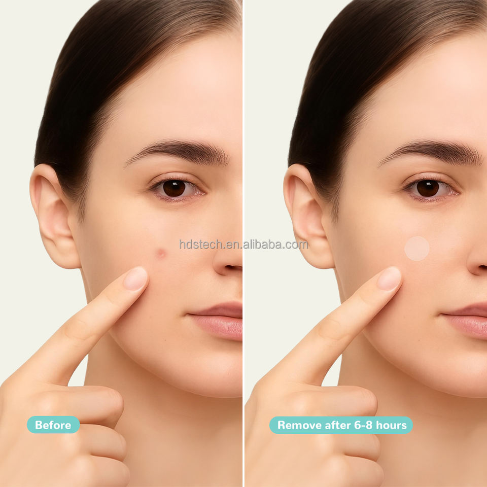 Bulk Hydrocolloid Acne Patch Ultra Thin Invisible Tapered Edge Clear ...