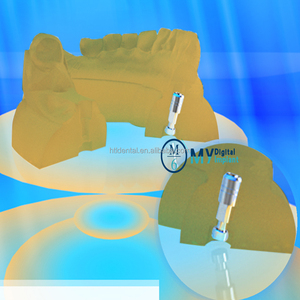Wholesale osstem implant model Items For Medical School Training ...