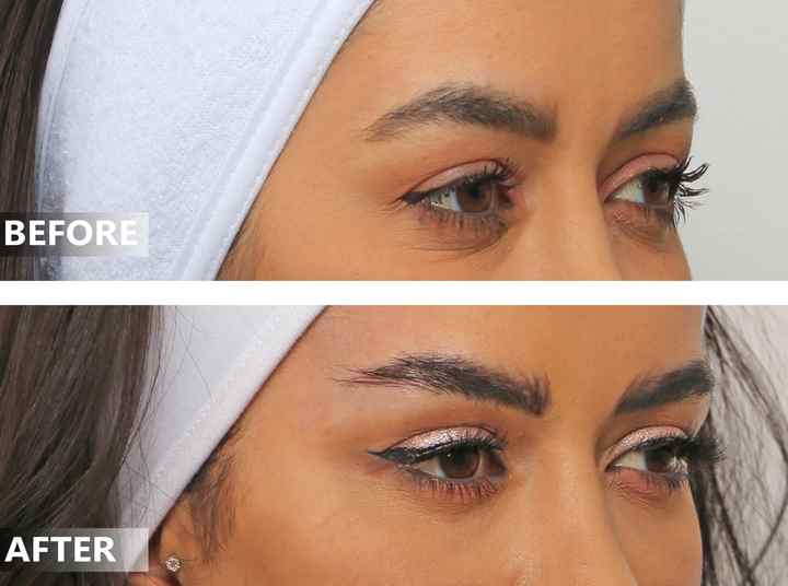 Korea pdo thread lift 4d 6d 8d12d cog 21g 60mm 100mm lifting threads ...