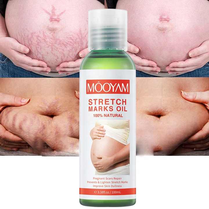 OEM Pregnancy Tummy Buttock Abdominal Acne Scars Removal Oil Repairing ...