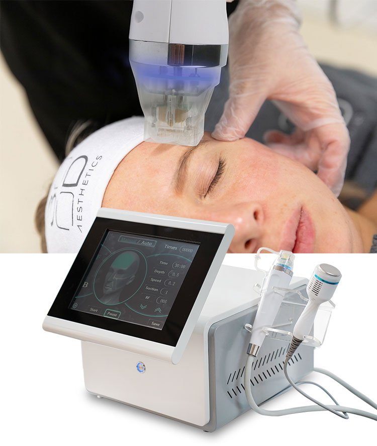 RF Microneedling Machine For Face Lifting & Skin Tightening ...