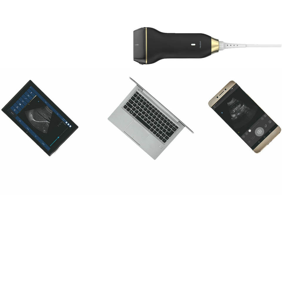 Medical Electric Handheld Ultrasound with Linear Probe for Vascular ...