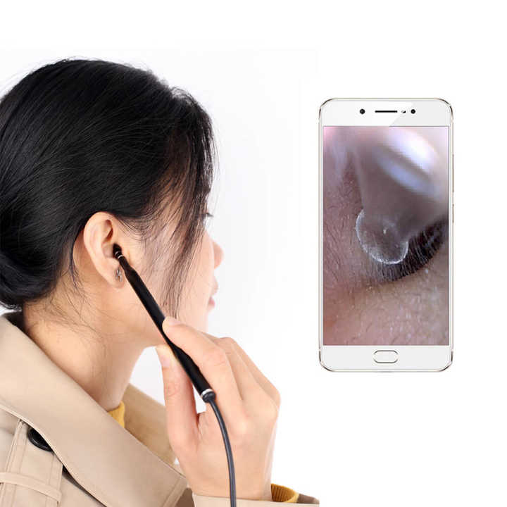 Smart Visual Ear Camera - HD Ear Scope Otoscope Endoscope