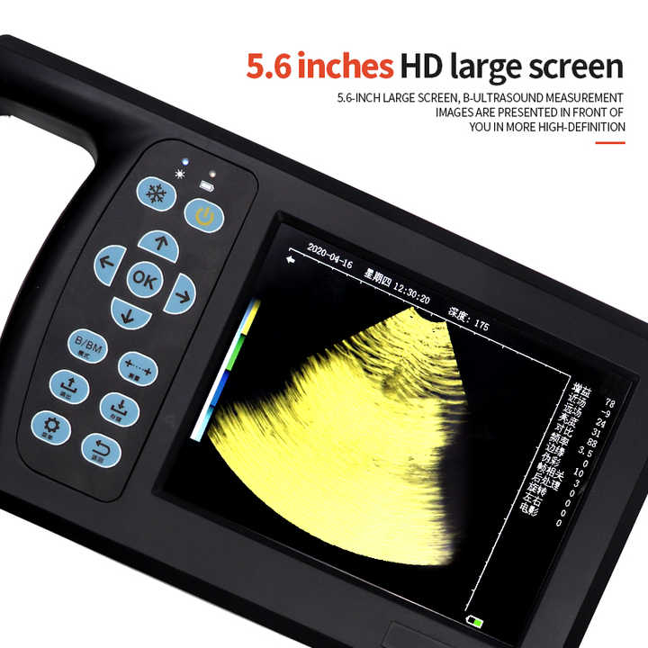 Portable Veterinary Ultrasound Scanner for Animal Pregnancy