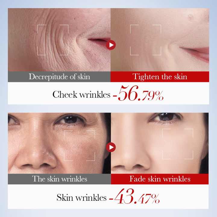 Sadoer Snail Collagen Anti-Wrinkle Face Skin Care Set English Factory ...