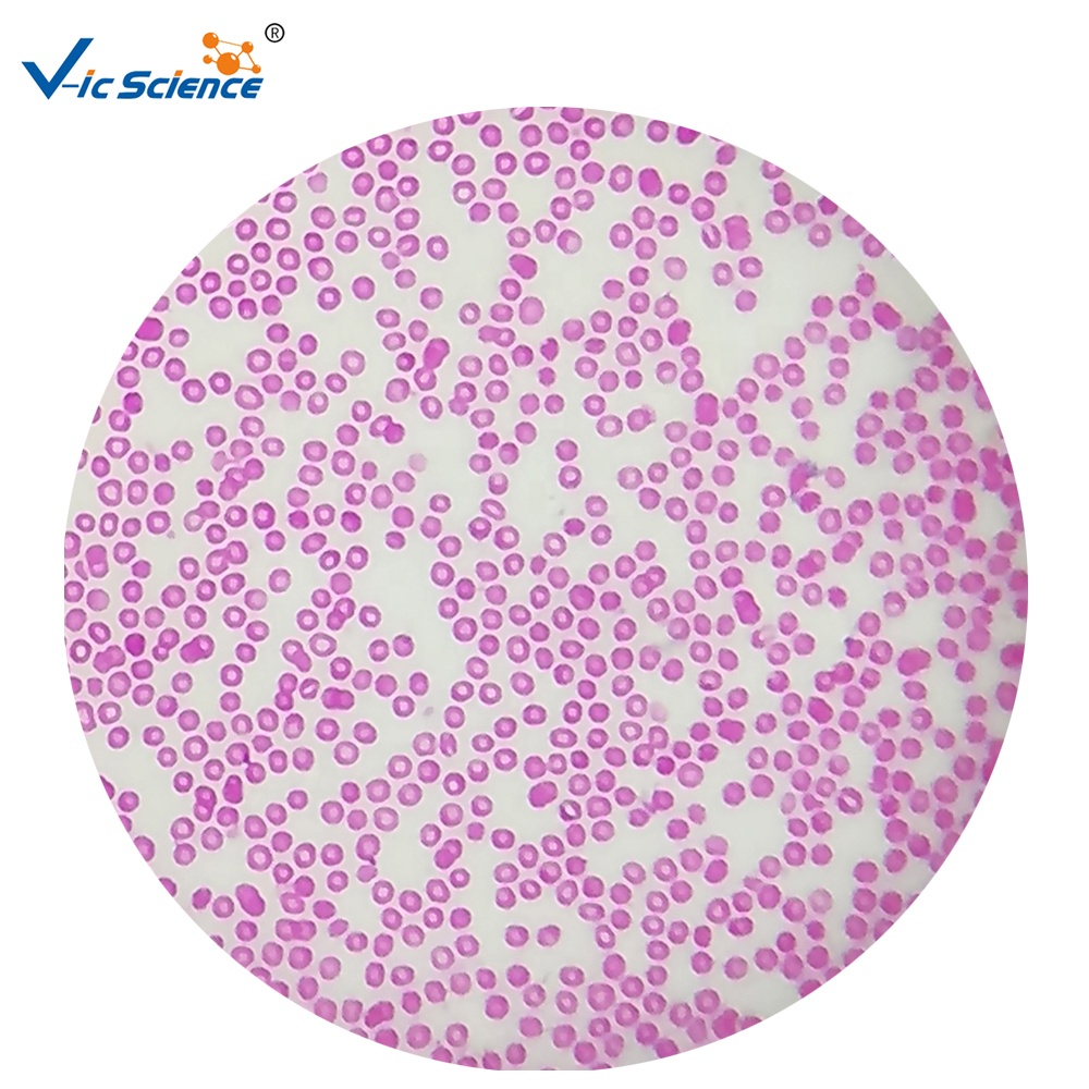 Blood Smear Slides - High Quality Hematology Prepared Slides