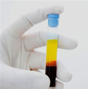 Essential Wholesale regen lab prp centrifuge At Affordable Prices- Alibaba.com