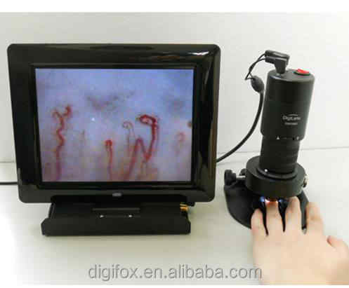 DMX980 Microscope microcirculation Microvascular capillary microscope ...