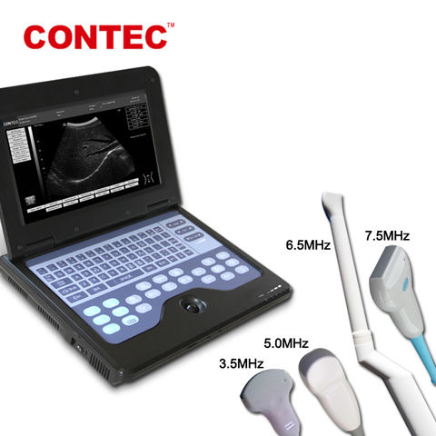 CONTEC CMS1700B Color Doppler 3D 4D Ultrasound Scanner