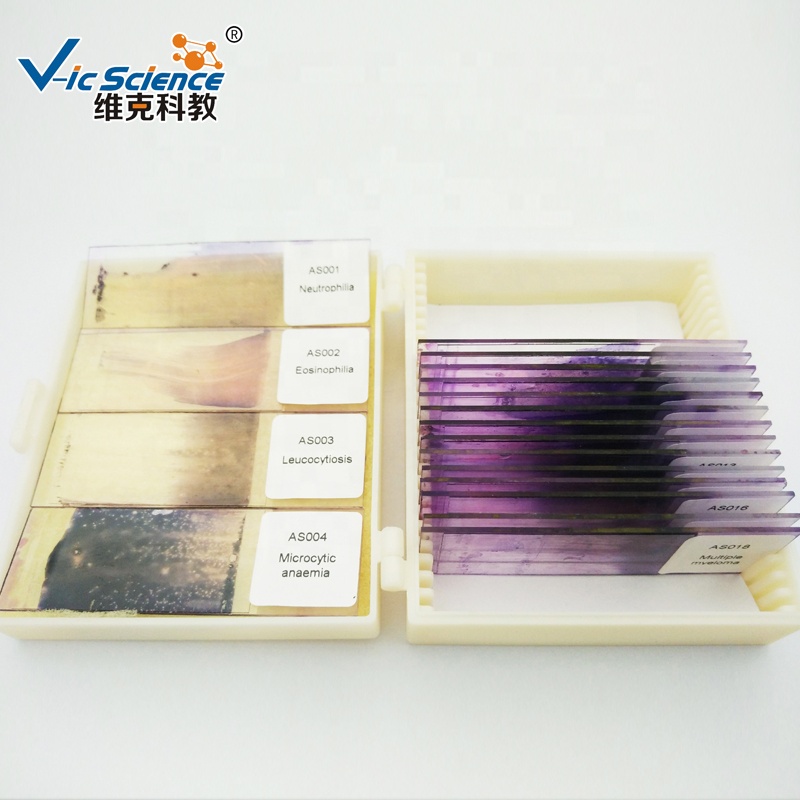 H&E Stained Human Blood Smear Prepared Slides Human Blood Smear ...