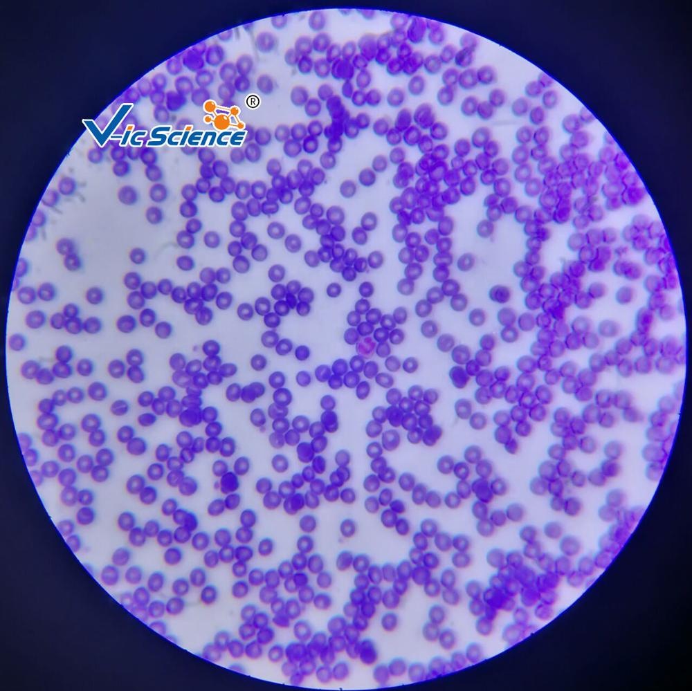 Blood Smear Slides - High Quality Hematology Prepared Slides