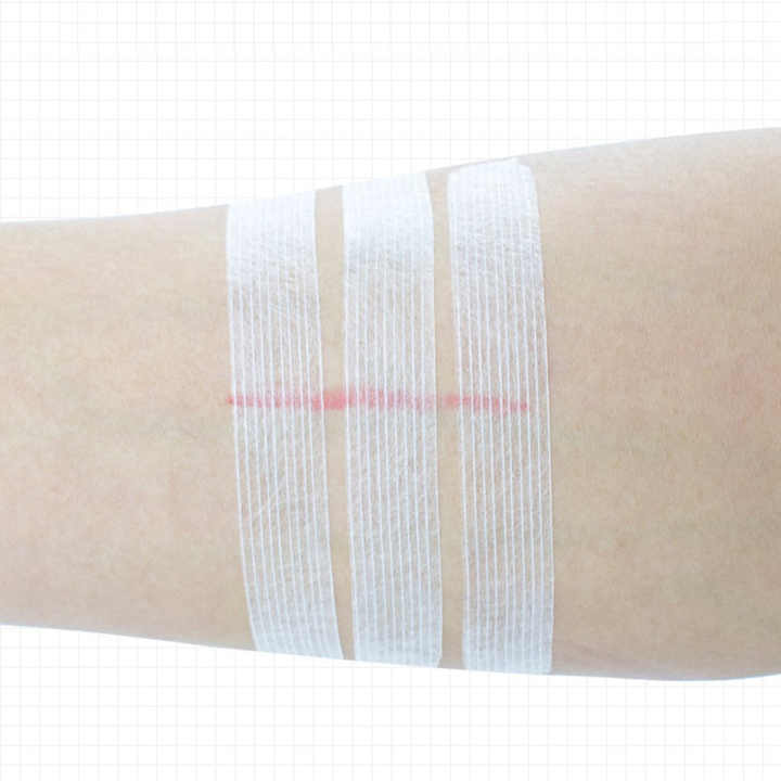 High Quality Disposable Sterile Adhesive Steri Strips White Color ...