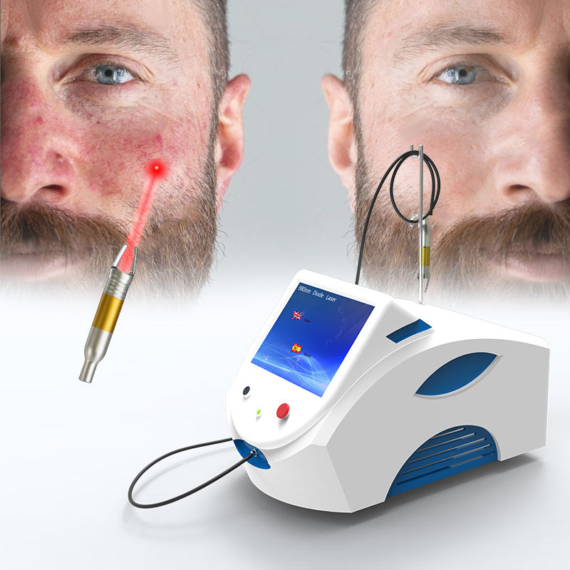 Portable Varicose Vein Removal 980nm Laser Treatment Machine Spider ...