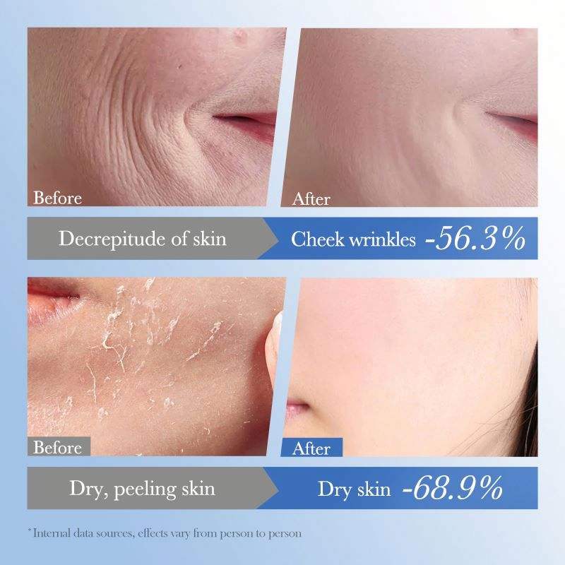 Korean Private Label SADOER Caviar Hyaluronic Acid Anti-Wrinkle Repair ...