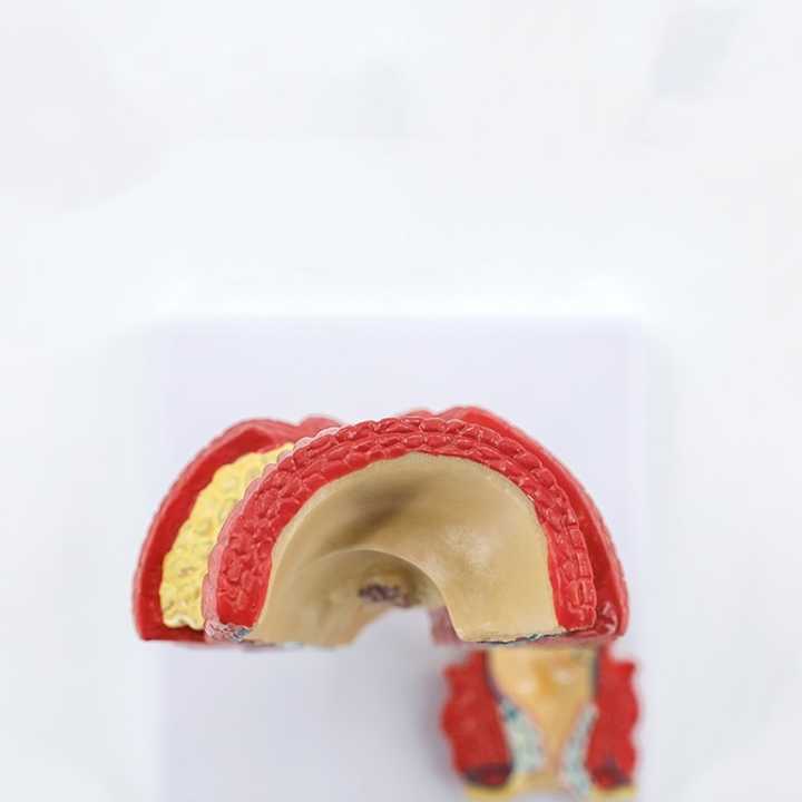 Rectal Hemorrhoids Colorectal Disease Model Internal And External