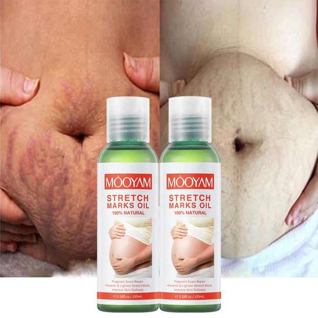OEM Pregnancy Tummy Buttock Abdominal Acne Scars Removal Oil Repairing ...