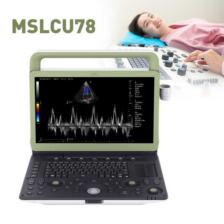 Portable Color Doppler Ultrasound Machine-Handheld Medical Imaging ...