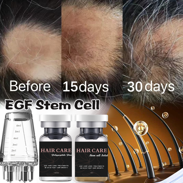 ZS Advanced Growth Factor Fast Hair Regrowth Treatment with Peptides ...