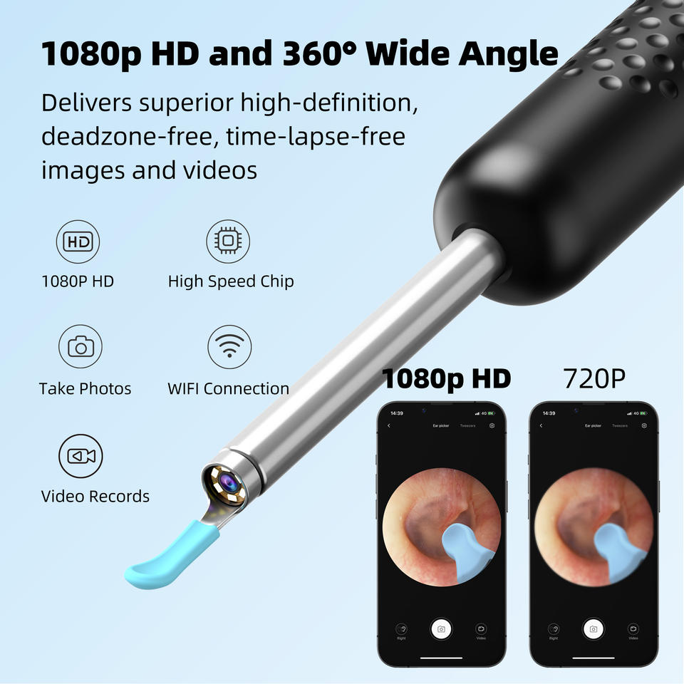 Bebird R1 Smart Wifi Digital Ear Nose Throat Inspection Camera
