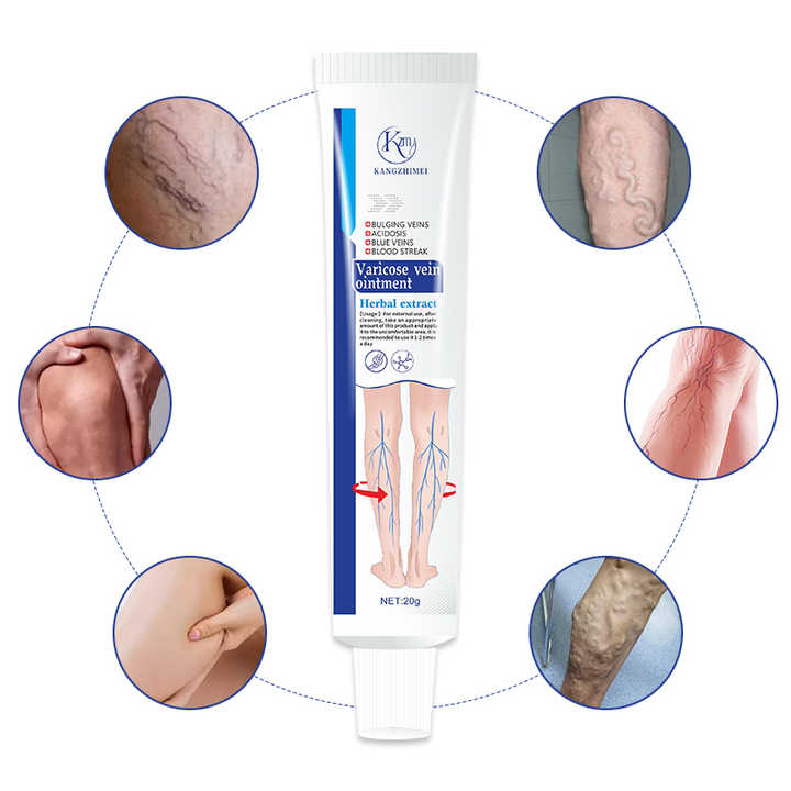 Hot Sales Varicose Vein Cream Spider Varicose Veins Cream for Pain ...