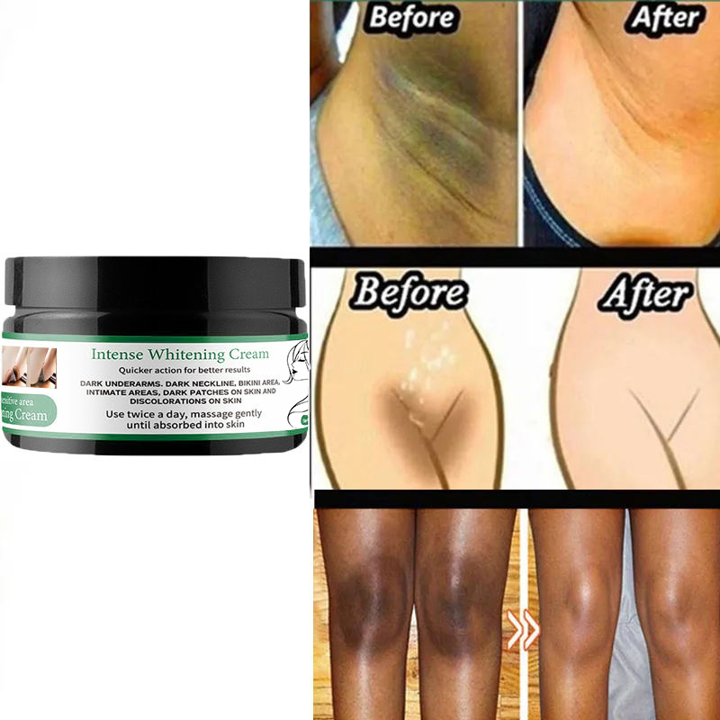 Dark inner thighs cream store