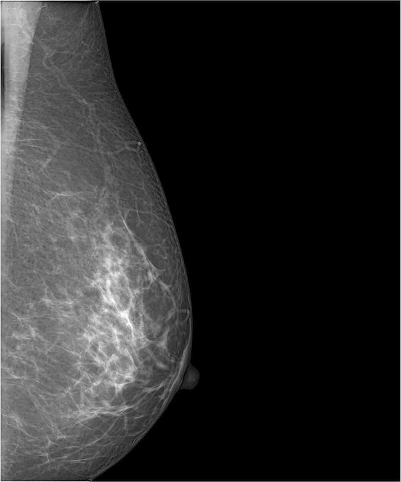 Mammography Detector 10"x12" For Digital DR wired Flat panel Mammogram ...