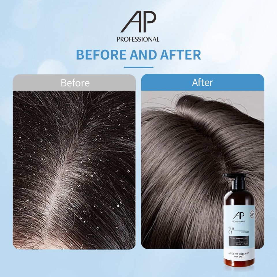 AP Sulfate Free Amino Acids Oil Control Hair Shampoo Wholesale Best ...