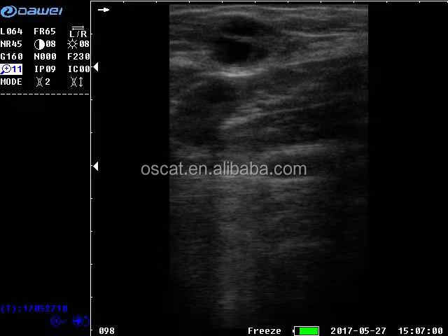 OSCAT Portable Horse Scanner Veterinary Equine Ultrasound Equipment for ...