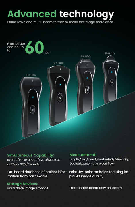 Yonker Pediatric Physical Exam Handheld Ultrasound Device Evaluate ...