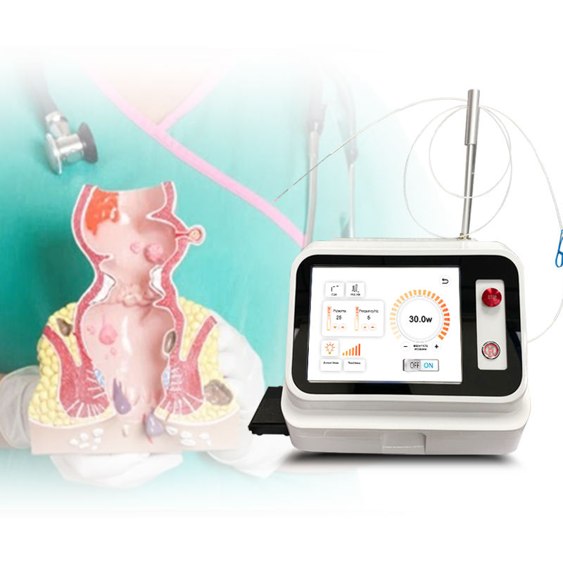 980nm Lightweight Hemorrhoid Treatment Laser Proctology Surgery Diode ...