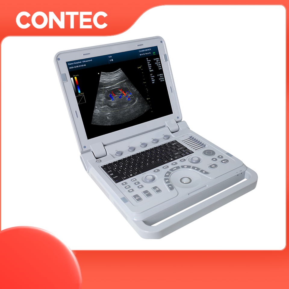 CONTEC CMS1700B Echocardiogram - Portable Ultrasound System