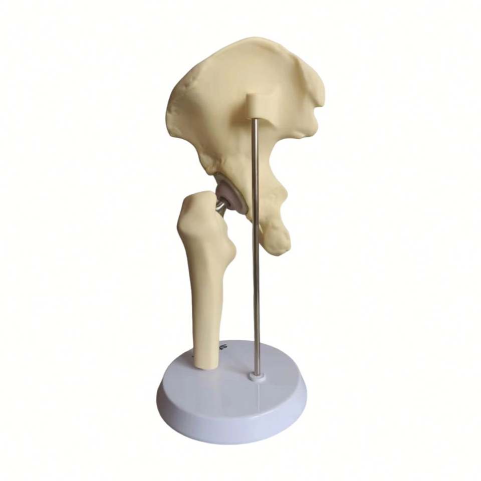 KyrenMed Hip Implant Model Artificial Hip Joint Replacement Model Life ...